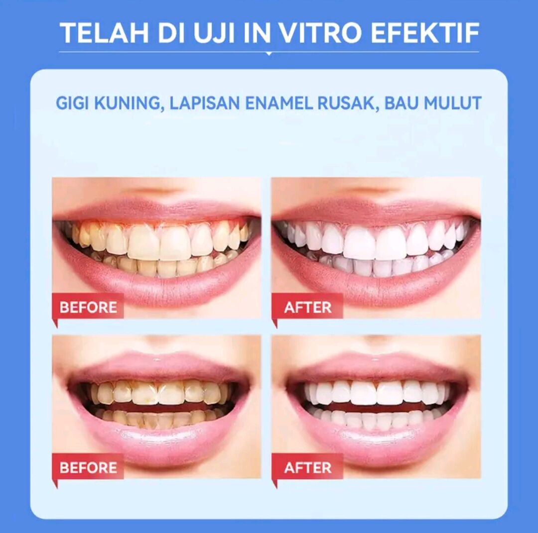 [FREE GIFT ISI 3PCS] SOPAMI SP7 PASTA GIGI PEMUTIH PROBIOTIK RASA ...