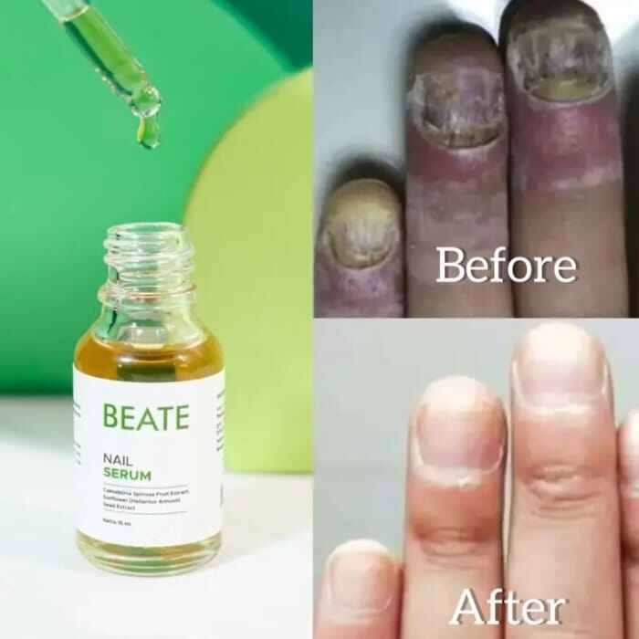 BEATE NAIL SERUM KUKU ORIGINAL | Lazada Indonesia