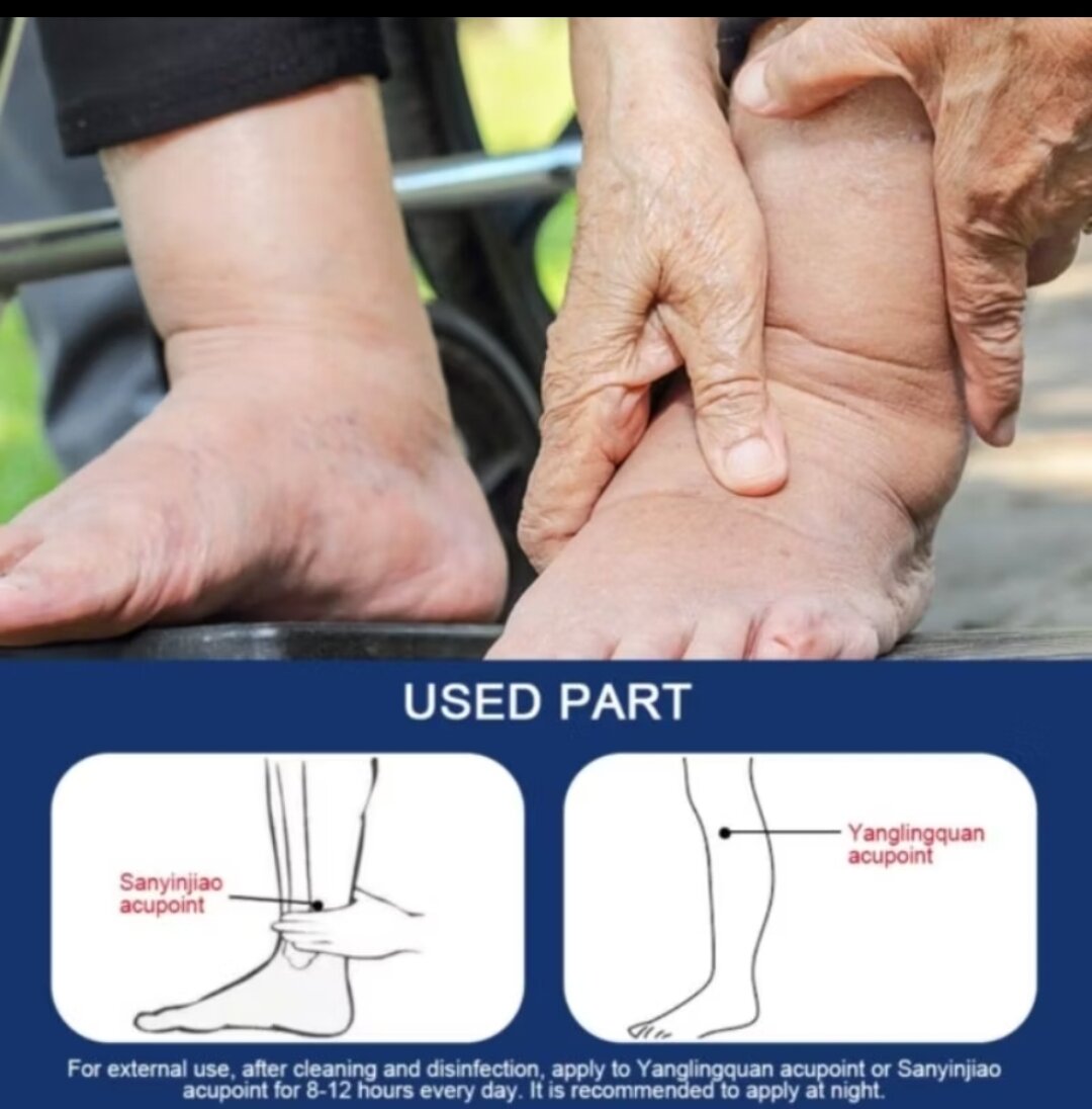 Sumifun Edema Leg Relief Patch Koyo Kaki bengkak | Lazada Indonesia