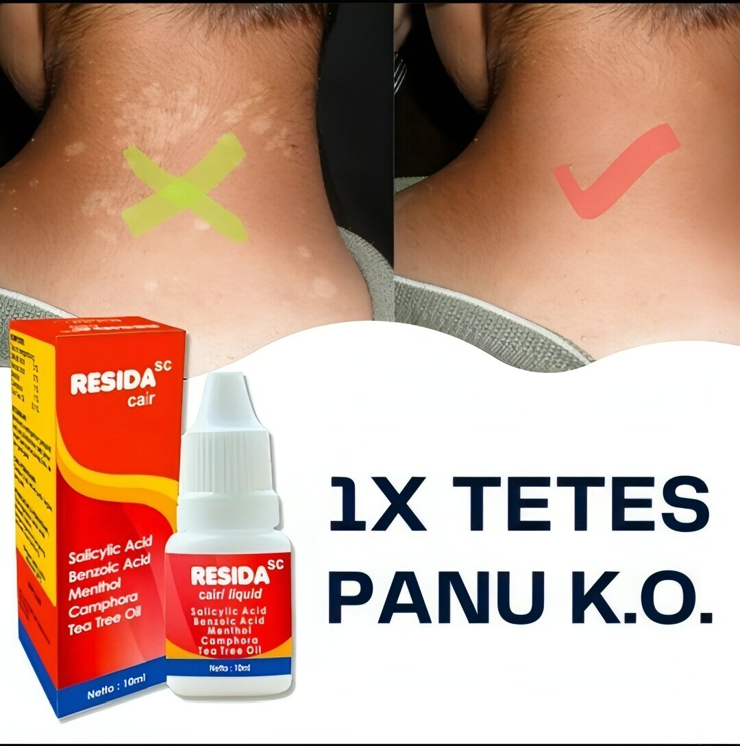 original kalpanax cair x resida cair obad panu kadas kurap kutu air ...