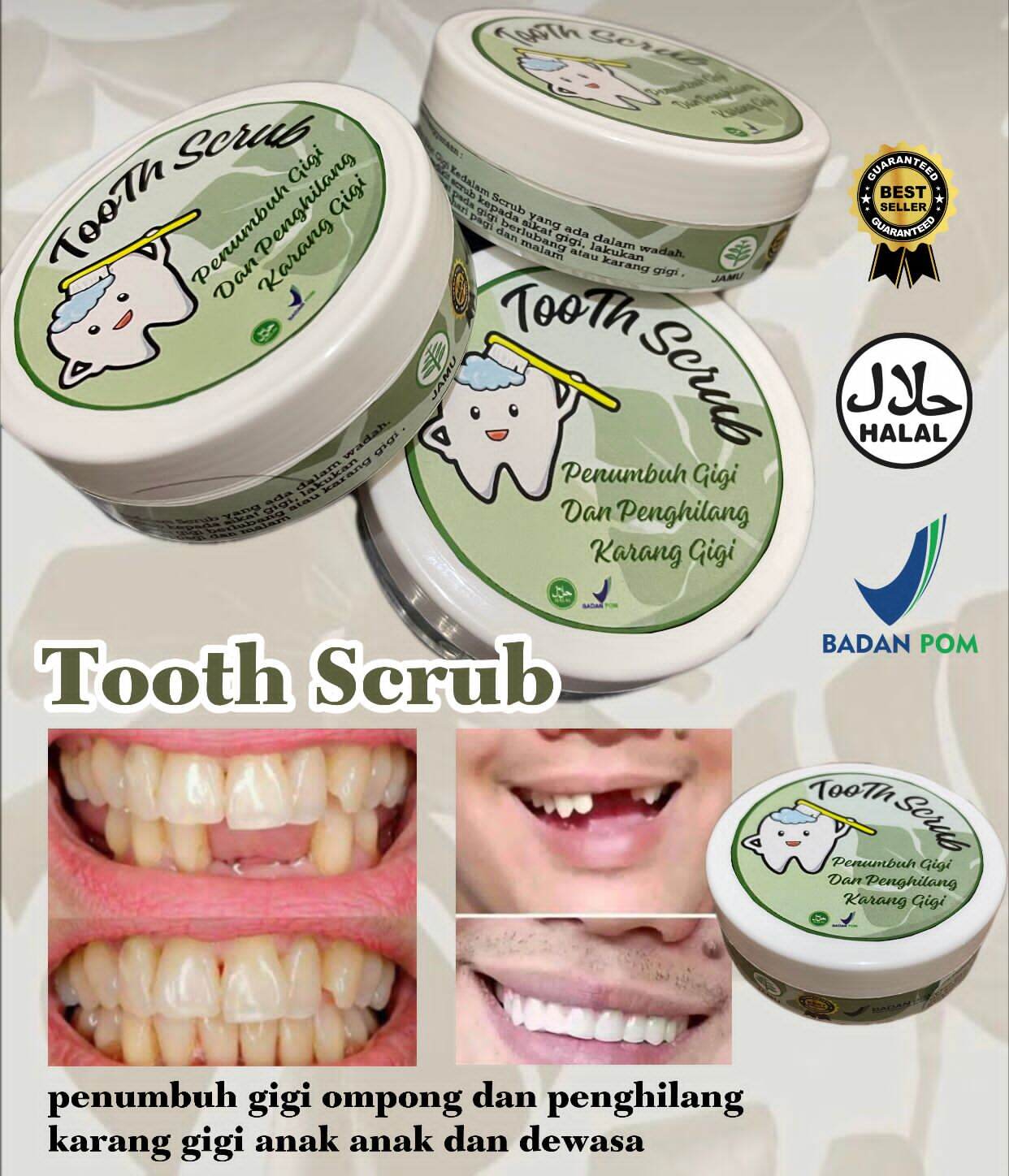 PENUMBUH GIGI ALAMI - Gigi Ompong Tertambal Lagi // Gigi Patah Rapih ...