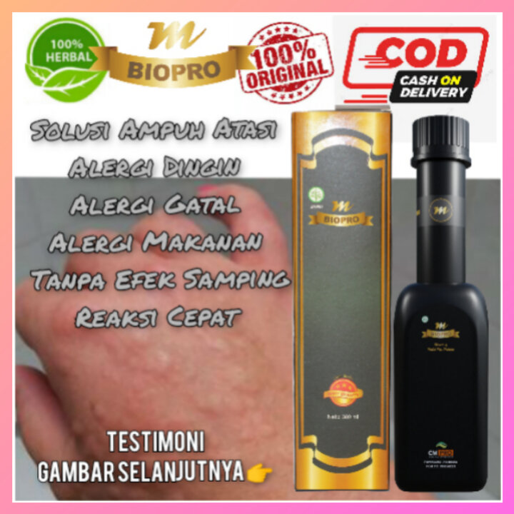 Obat Alergi Dingin, Obat Alergi Gatal Kulit Paling Ampuh Isi 380 ml M ...