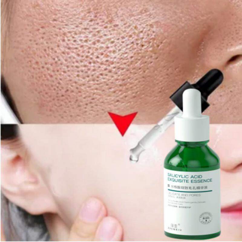 ZHENXIU Salicylic Acid Serum Skincare 30ml Serum Wajah - Untuk ...