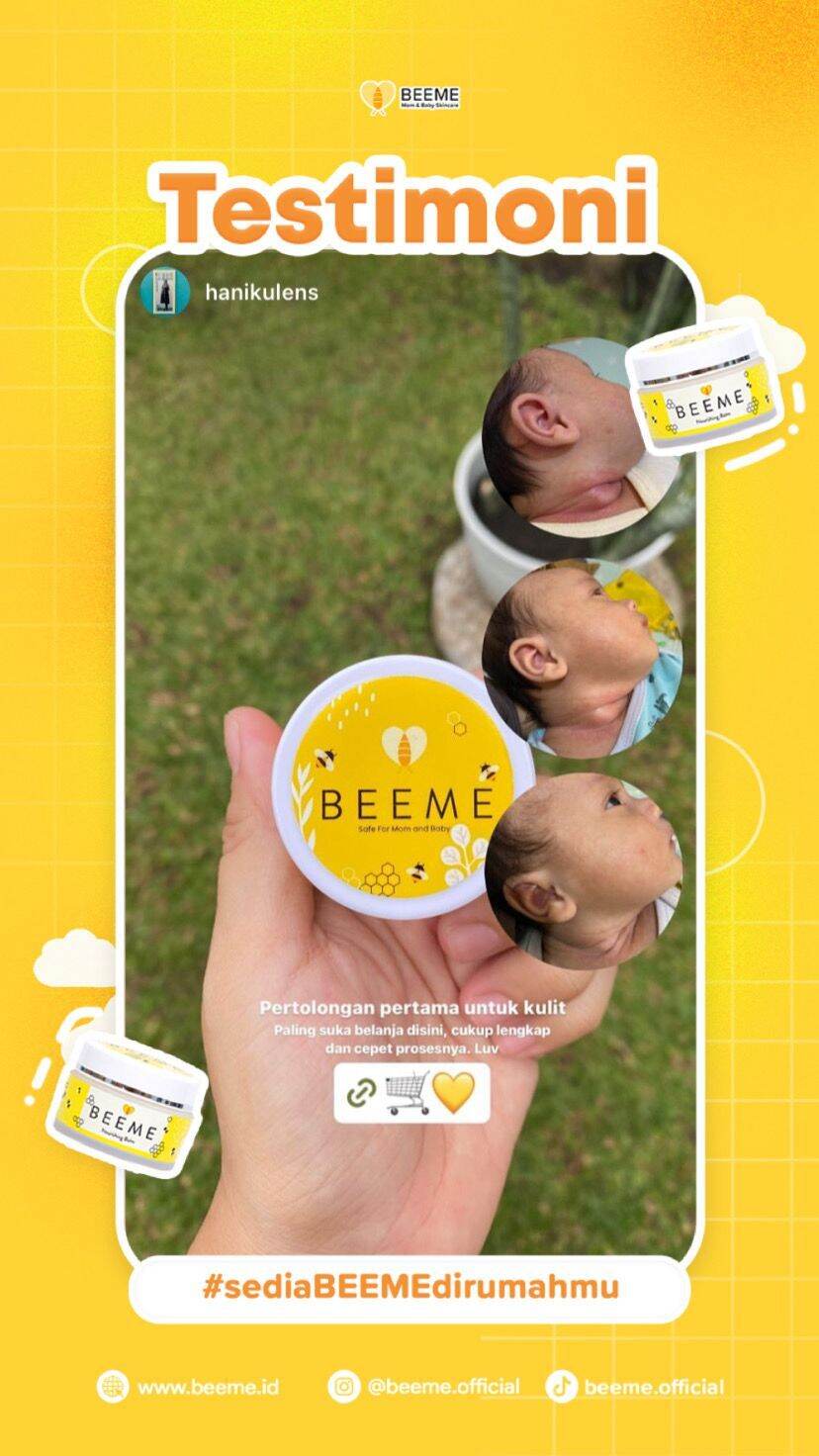 Beeme Nourising Balm, skincare ibu dan anak | meydinzashop | Lazada ...