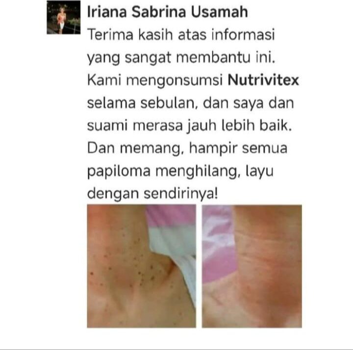 NUTRIVITEX Original Asli Herbal Untuk Pembasmi Parasit Tubuh Terampuh ...