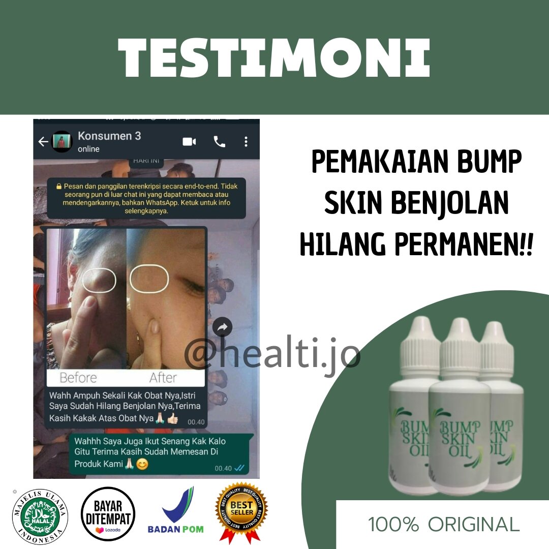 BUMP SKIN OIL | OBAT BENJOLAN | OBAT BENJOLAN DI LEHER AMPUH TERBAIK ...