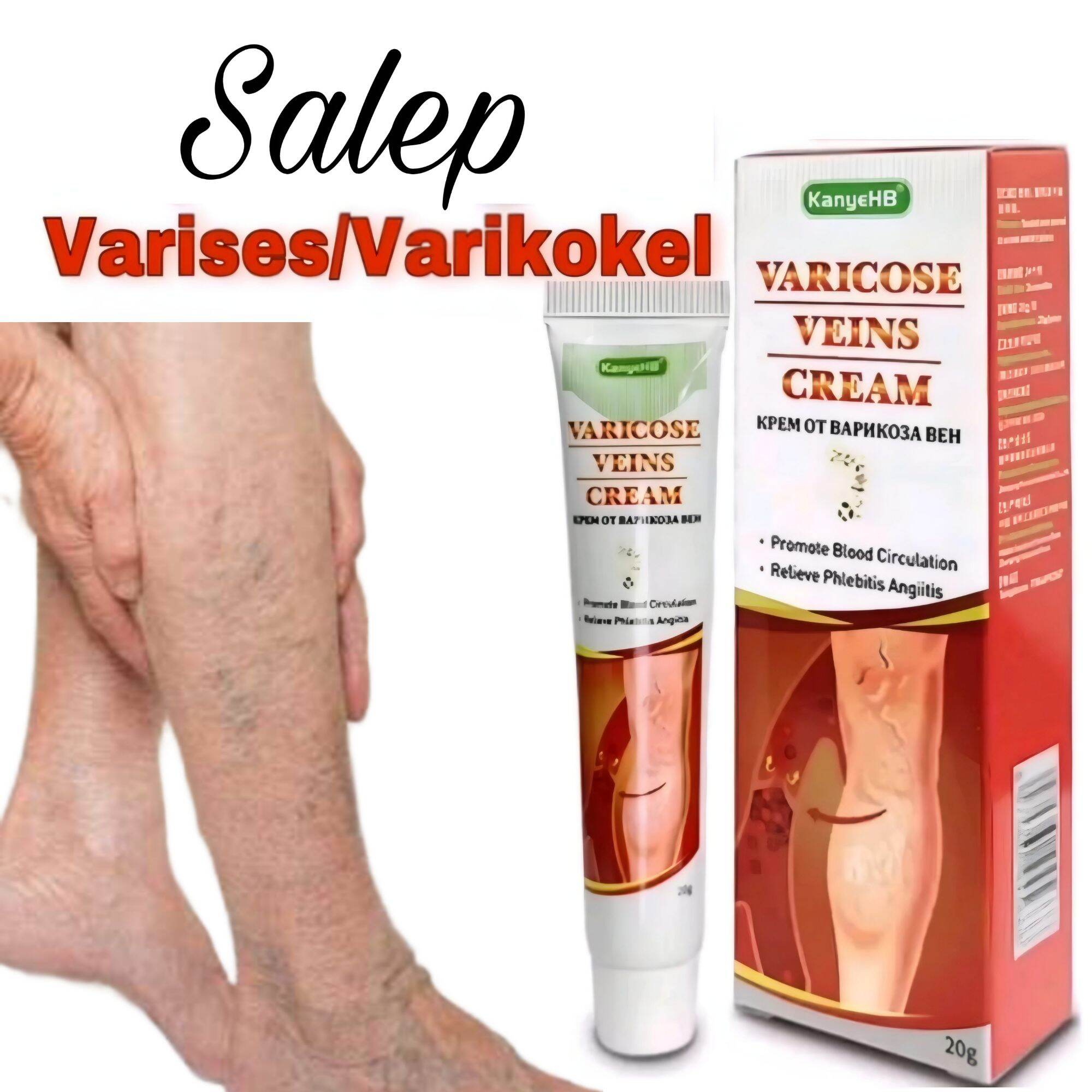 Varicose Veins Cream 20gr Salep Obat Varises Penghilang Parises ...
