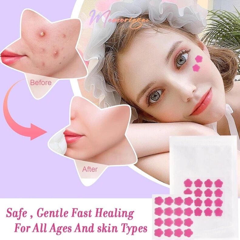 Acne Patch Bentuk Lucu Stiker Bintang Cinta Tapak Kucing Paw Love Hati ...