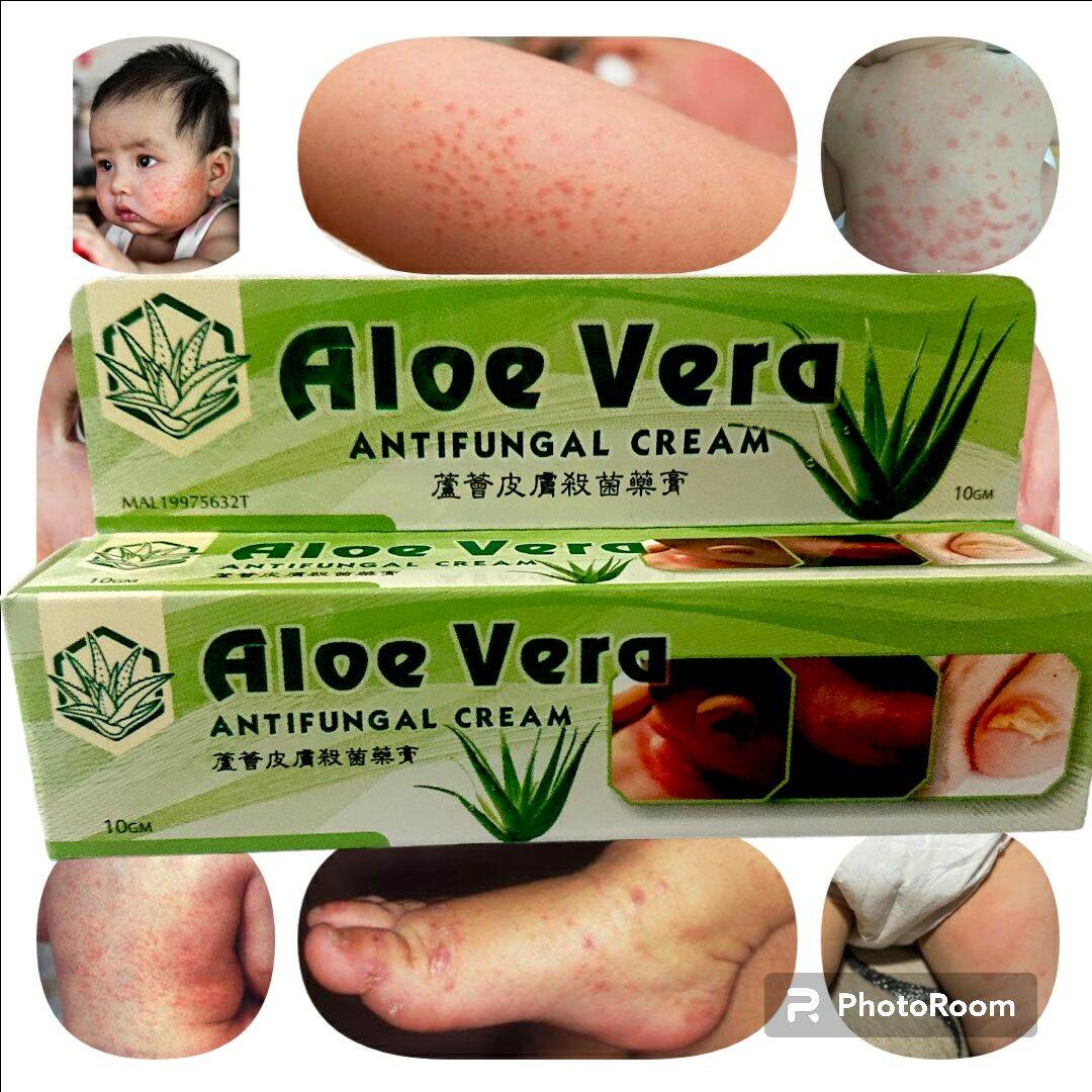 OBAT IRITASI KULIT BAYI AMPUH- RUAM POPOK - LECET LEHER - KURAP ASI ...