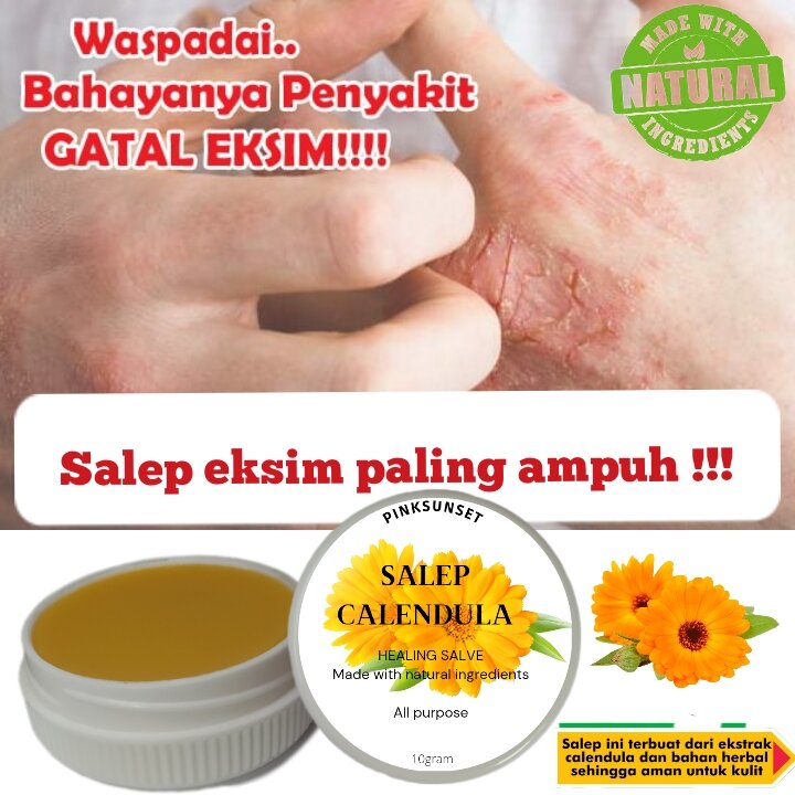 Salep Natural Calendula Salve Salep Eksim Kering Salep Gatal Psoriasis ...