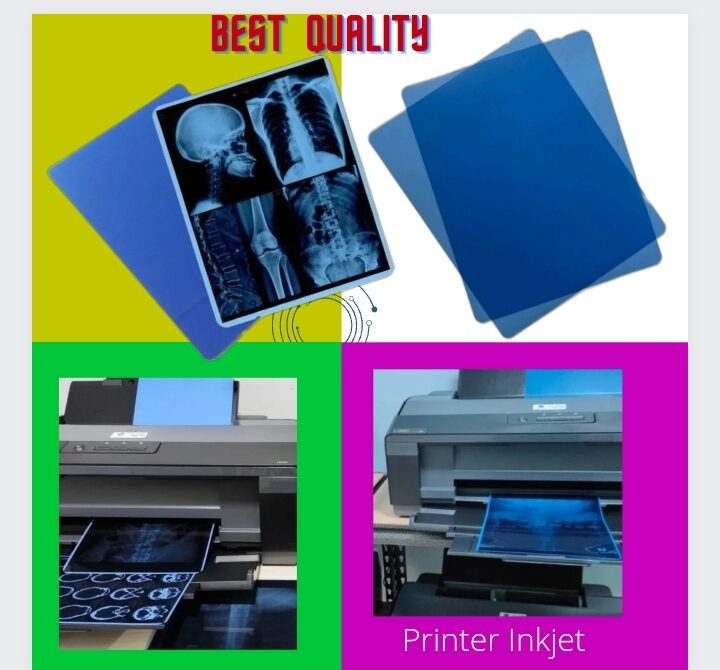 Dry Film inkjet medical Radiologi Rontgen X-Ray (Blue base A4) | Lazada ...