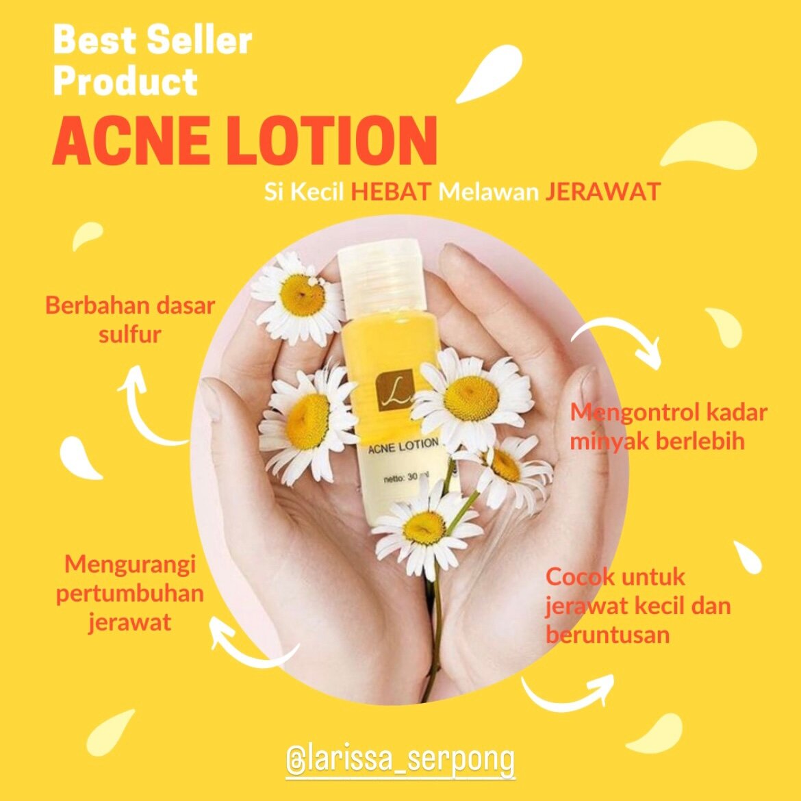 Acne Lotion Larissa | Lazada Indonesia