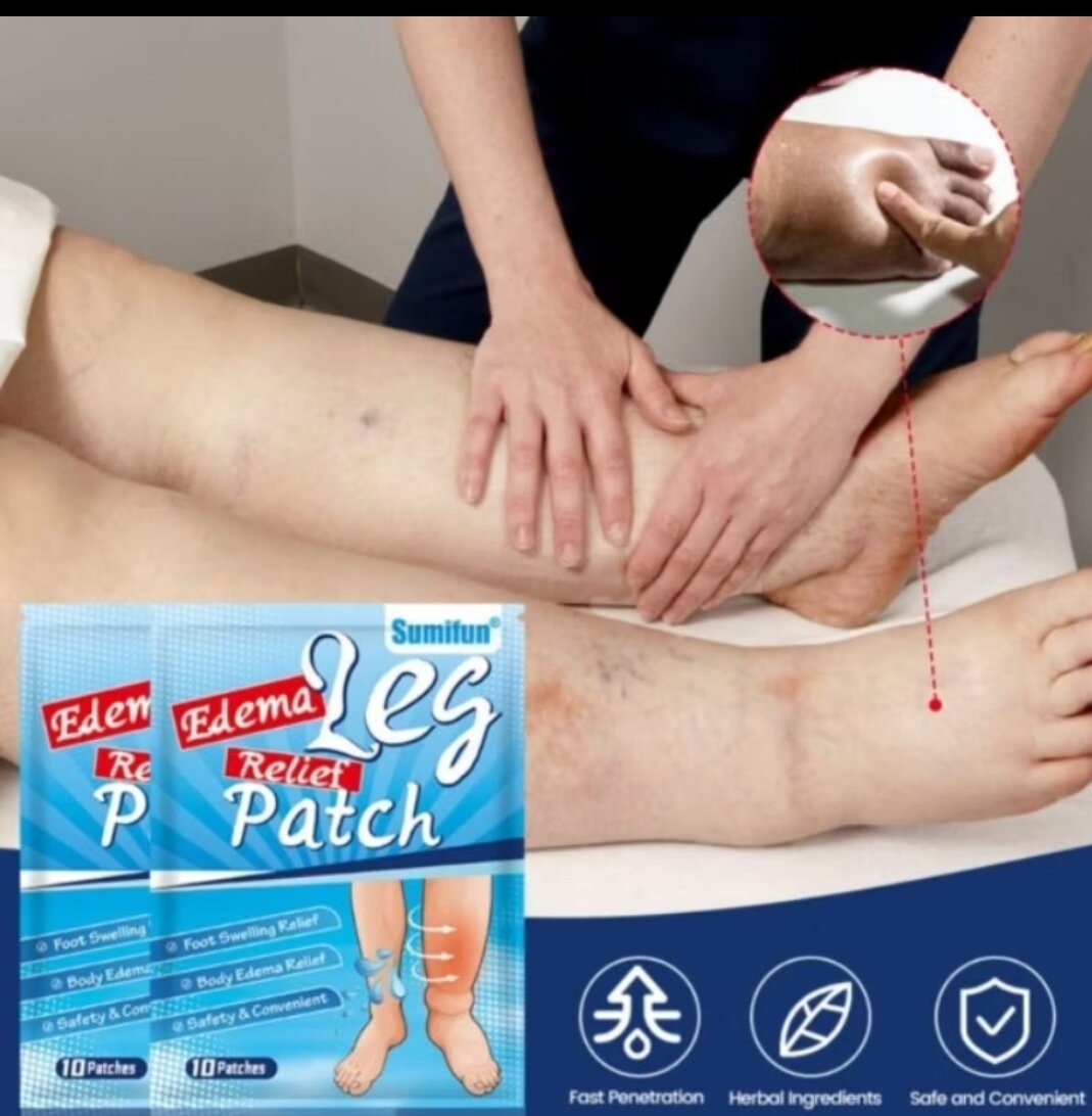 Sumifun Edema Leg Relief Patch Koyo Kaki bengkak | Lazada Indonesia