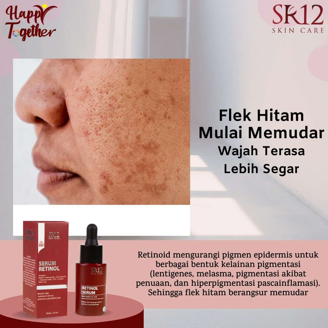 Penghilang Flek Hitam Memudar Wajah terasa Lebih Segar dengan Serum Retinol SR12 | Lazada Indonesia