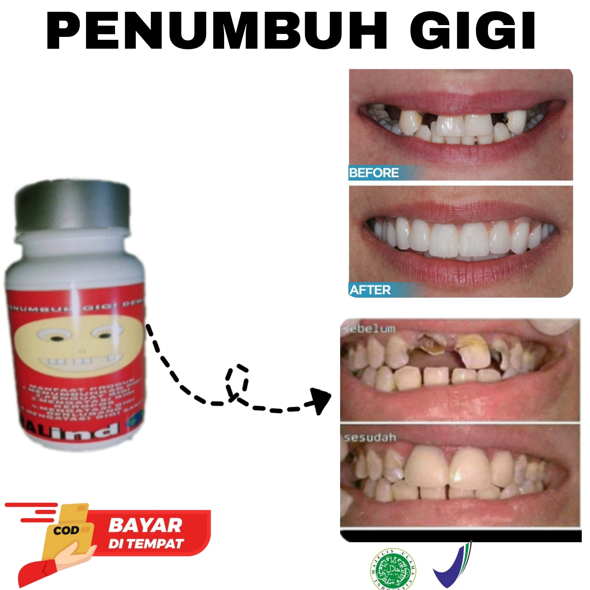 VITAMIN PENUMBUH GIGI DEWASA | Lazada Indonesia